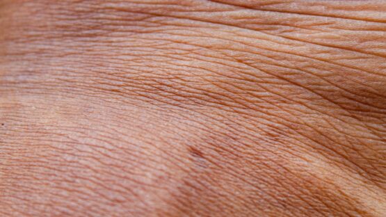 A New Approach to Treating Aging Skin | Lifespan Research Institute