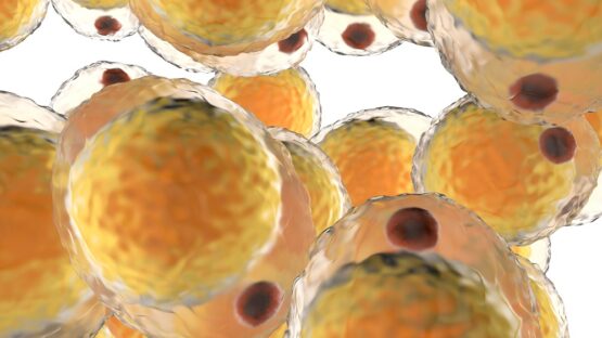 Subcutaneous and Visceral Fat React Differently to Obesity